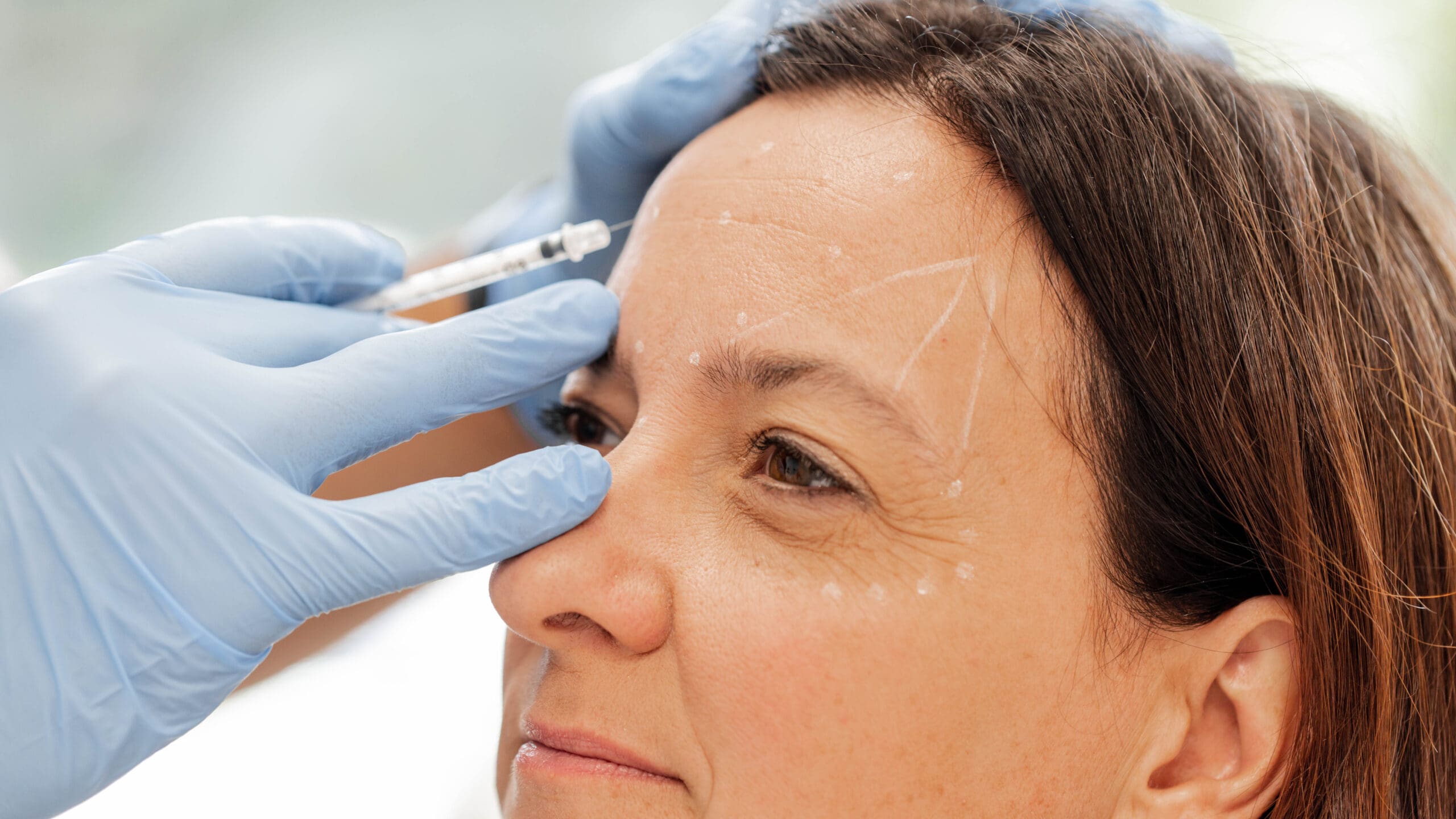 Rides et ridules | Cliniques Viva